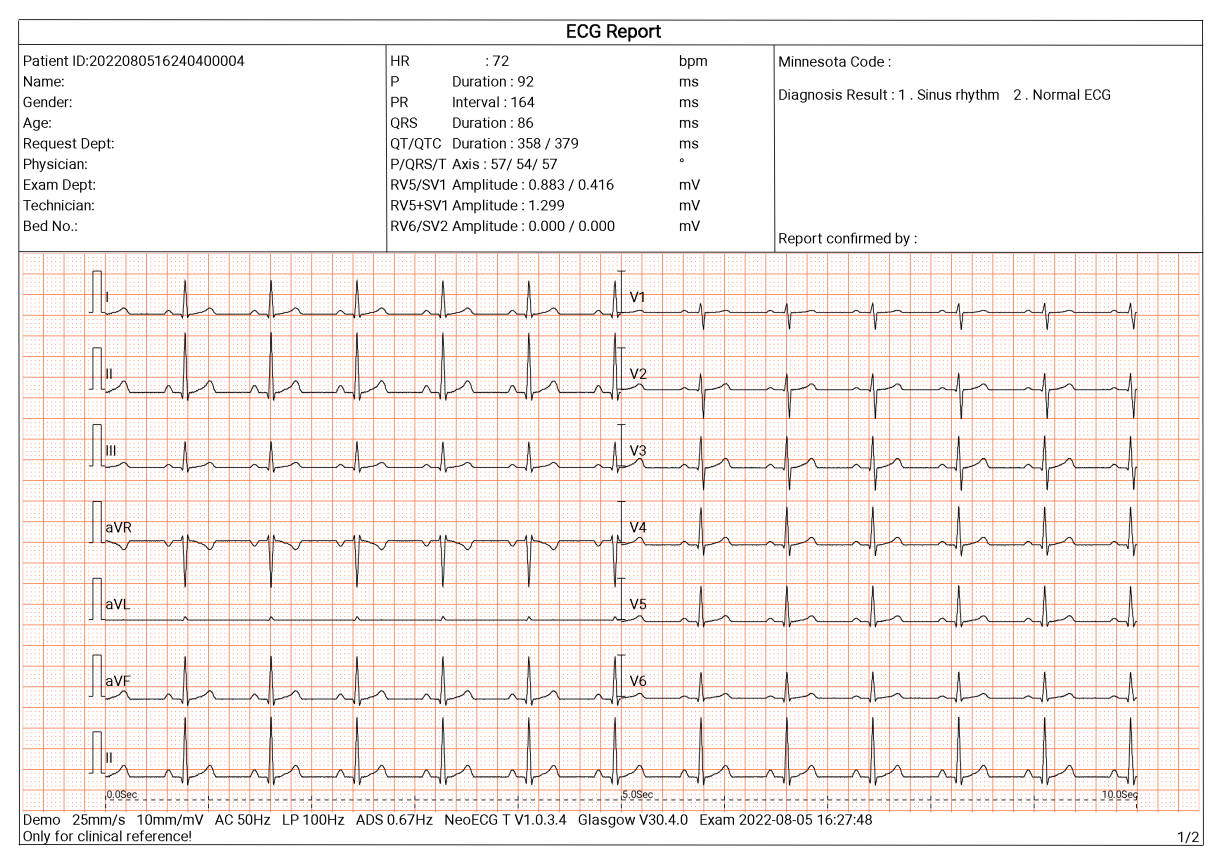 Mobile 6/12-Lead EKG/ECG Machine Fits into Your Pocket, with Auto Interpretation, Wirelessly ...